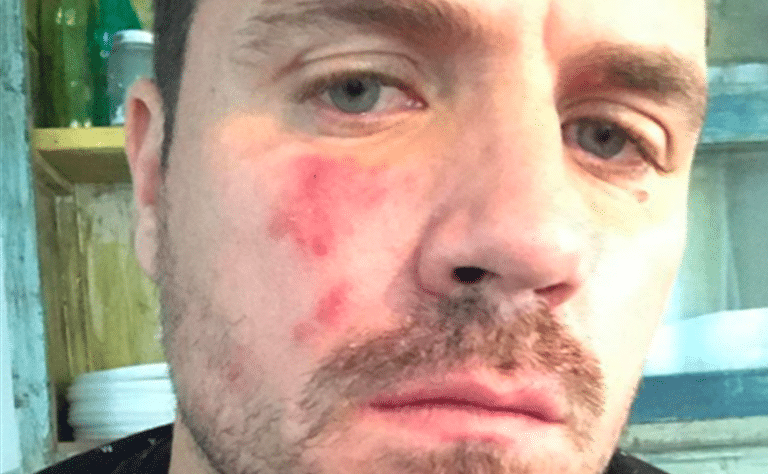 Dani Martín: La muerte de su hermana, sus parejas y su enfermedad